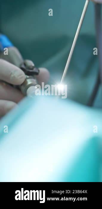 Vertical Screen: Close-up of a surgeons hand using a laparoscopic ...
