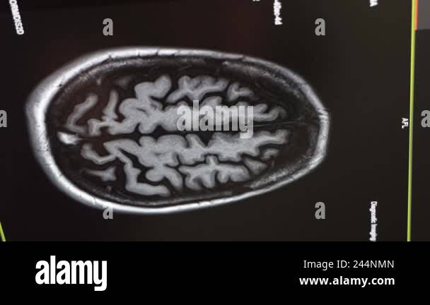 Mri of the blood vessels Stock Videos & Footage - HD and 4K Video Clips ...
