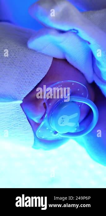 UV light phototherapy for a newborn child. Treatment of childhood ...