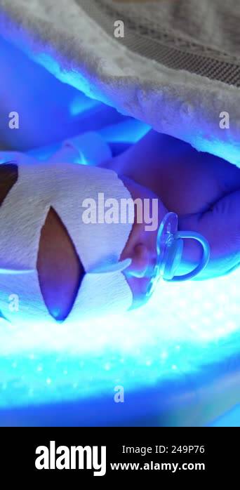 Tiny newborn baby it cured from the childhood jaundice. Infant in eye ...