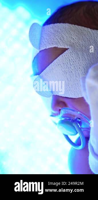Tiny child with bandage on eyes sleeps on ultraviolet lamp ...