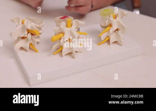spine models, anatomical spine, vertebrae model. Detailed view three ...