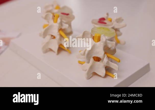 vertebrae model, nerve structure, spinal discs. Three anatomical spine ...