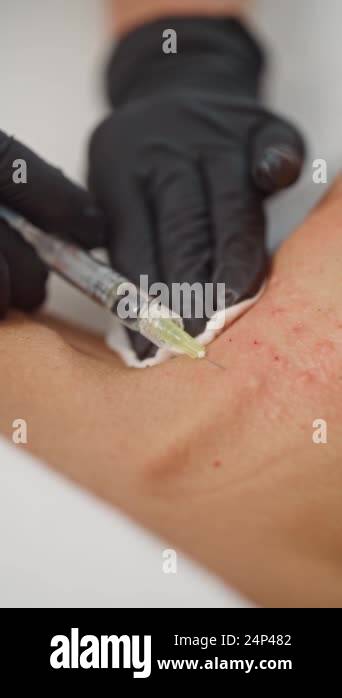 Macro video of a skin injection made by a beautician. Lifting and ...
