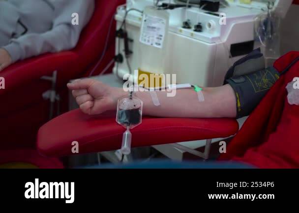 A man donates blood. The blood goes into a blood collection bag. A ...