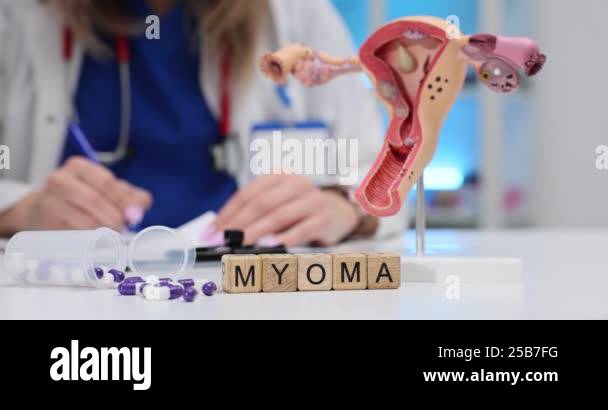 Myoma word and anatomical uterus model on gynecologist table. Doctor ...