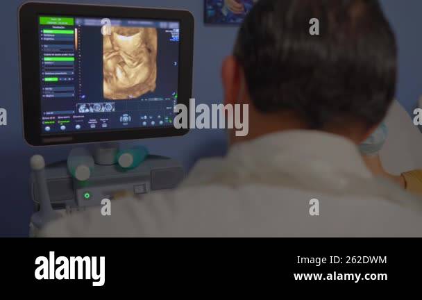 Ultrasound machine screen displaying a 3D image of a baby in the late ...