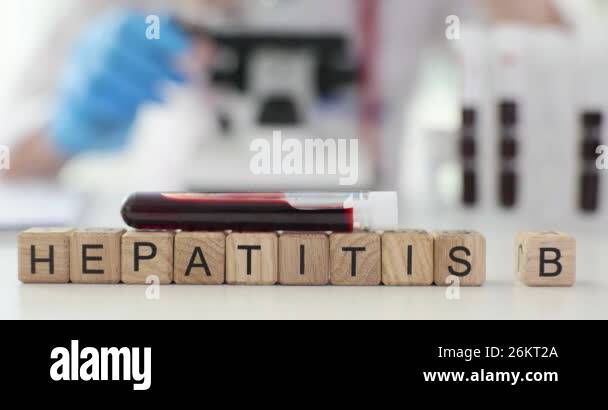 Process of testing for hepatitis B using a blood sample in laboratory ...