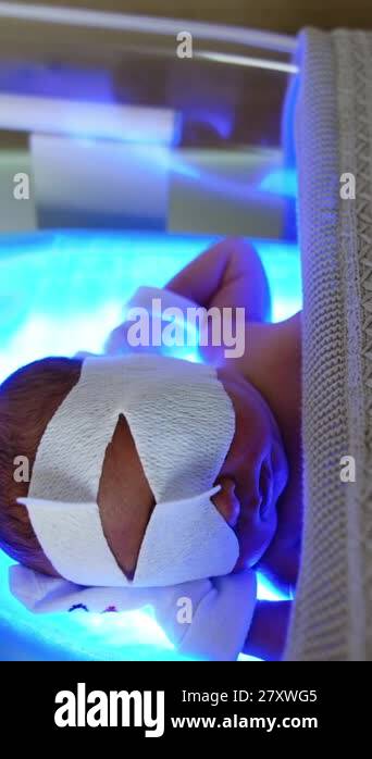 Little infant with bandage on eyes lies in a crib hand behind head ...