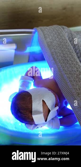 Newborn Caucasian baby lies on UV lamp in a crib. Infant having high ...
