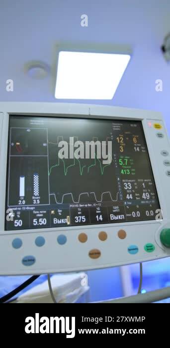 Life parameters of the patient at the monitor of artificial lung ...