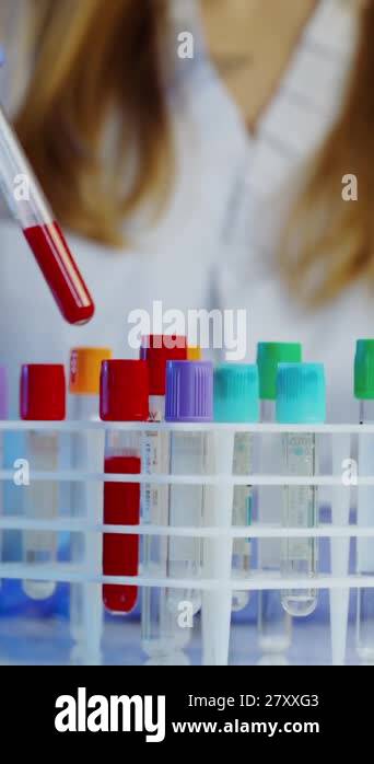 Blood sample tubes. Doctor hand taking a blood sample tube from a rack ...