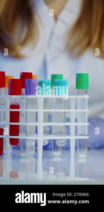 Scientist holding test tube. Technician of health with blood tubes in ...