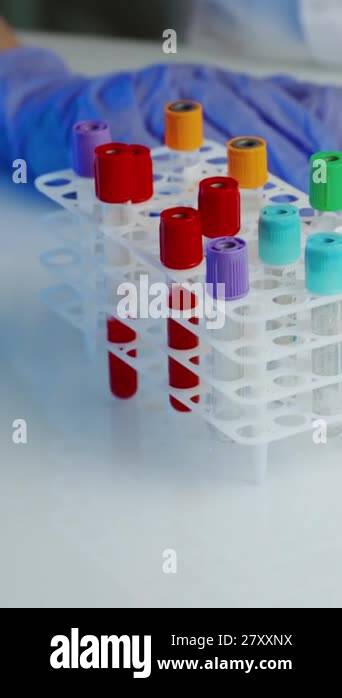 Test tubes with blood samples. Lab technician assistant analyzing a ...