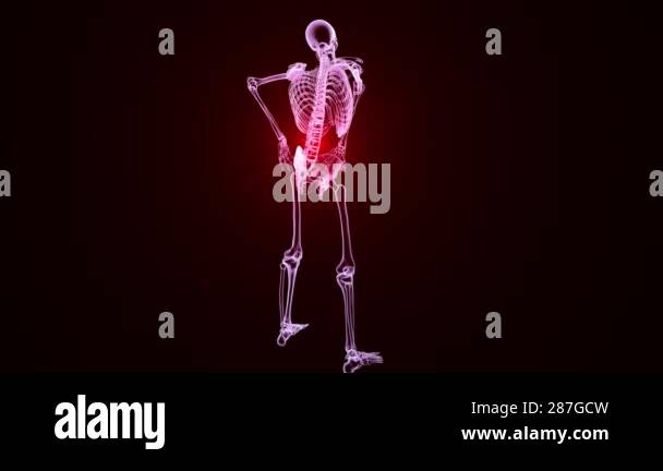 Sciatic nerve x ray Stock Videos & Footage - HD and 4K Video Clips - Alamy