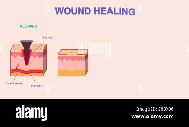 Healing stages Stock Videos & Footage - HD and 4K Video Clips - Alamy