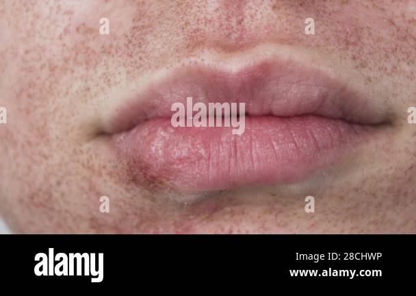 Woman lips scar removal procedure Stock Videos & Footage - HD and 4K ...