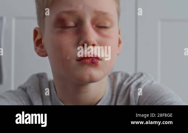A young child with disheveled hair is visibly upset, resting their head ...