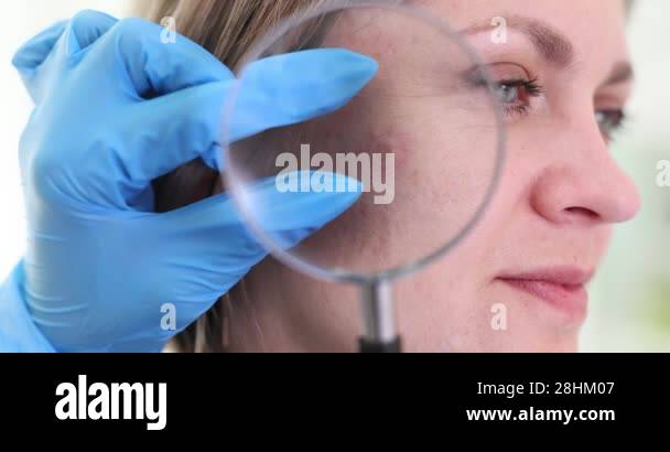 Professional dermatologist examines pimple on woman face of patient ...
