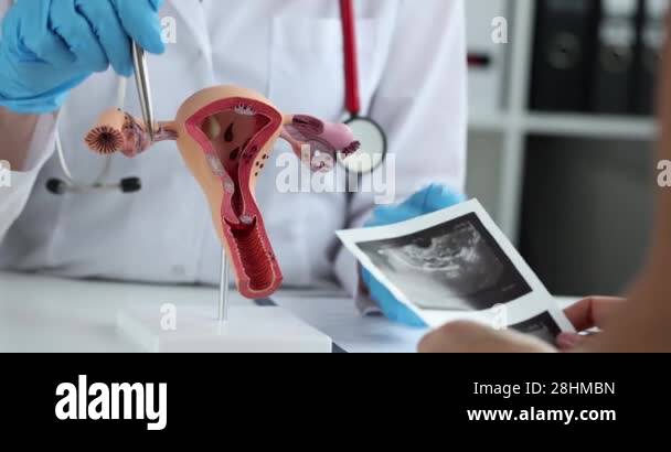 A doctor provides a detailed demonstration of female reproductive anatomy during a patient ...