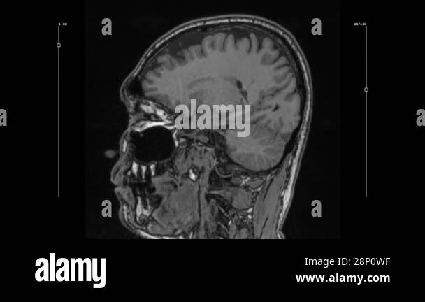Mri brain scan sagittal view Stock Videos & Footage - HD and 4K Video Clips - Alamy