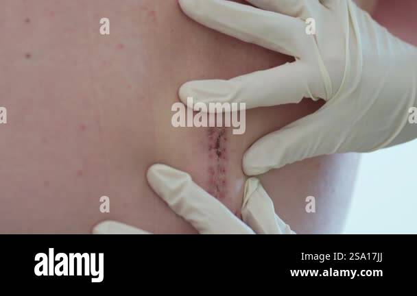 Skin condition evaluation Stock Videos & Footage - HD and 4K Video ...