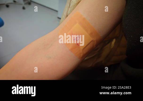 Cut on arm covered with bandage in hospital emergency. Wound treated ...
