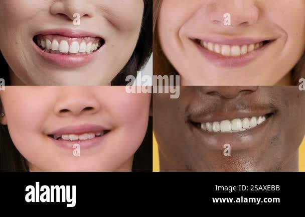 Four individuals display bright smiles, highlighting healthy teeth ...