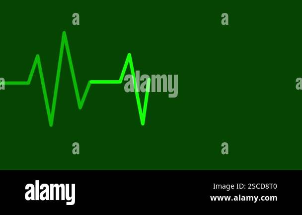 Animation of A green heart rate monitor line on a dark background ...