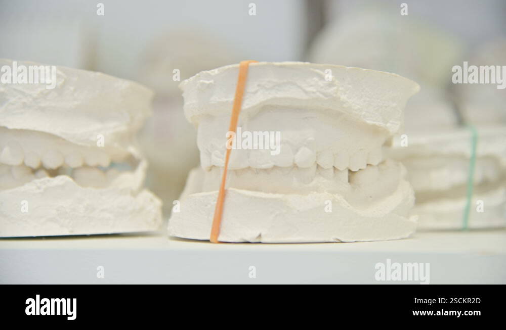 Dental gypsum model cast of human dental jaw. Laboratory prosthetics ...