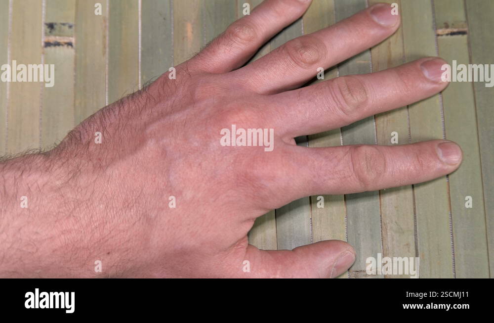 man removes his hand, leaving lying a black pirate mark of death Stock ...