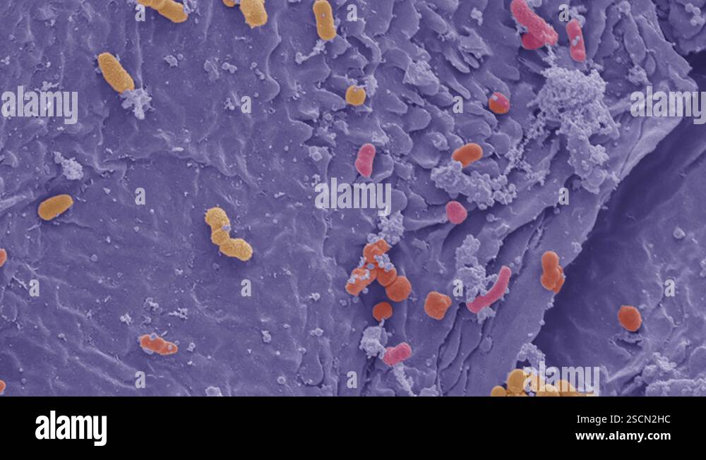 Staphylococcus aureus image Stock Videos & Footage - HD and 4K Video Clips - Alamy
