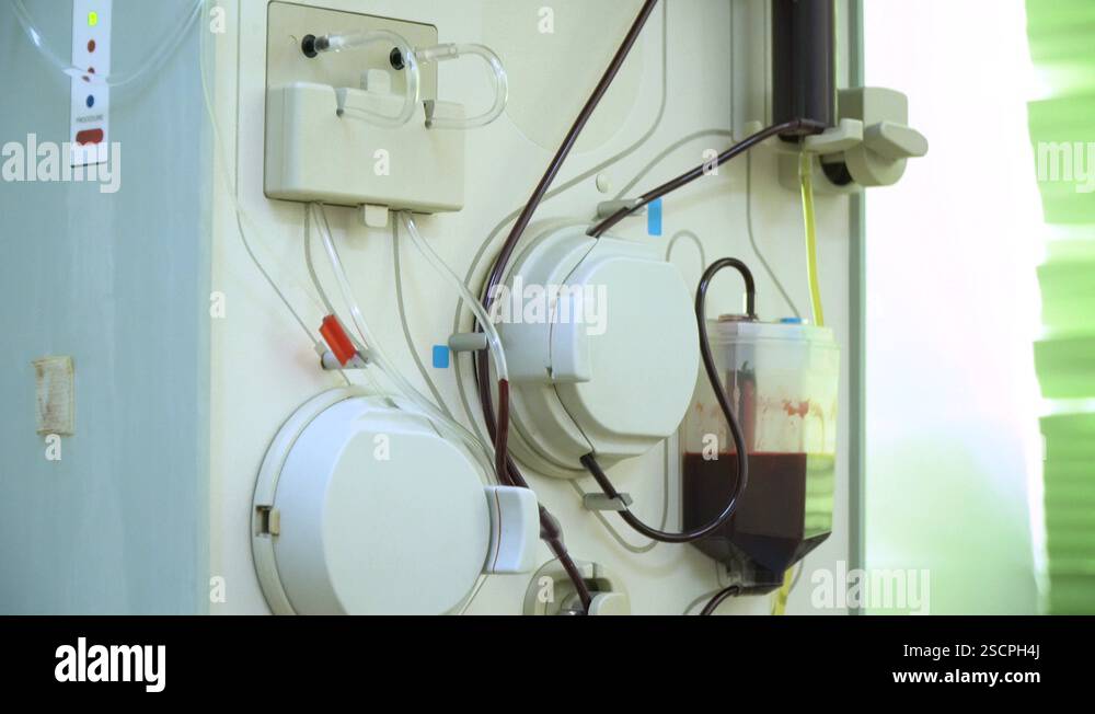 Plasmapheresis. Cleaning the patient's blood through the device. The ...