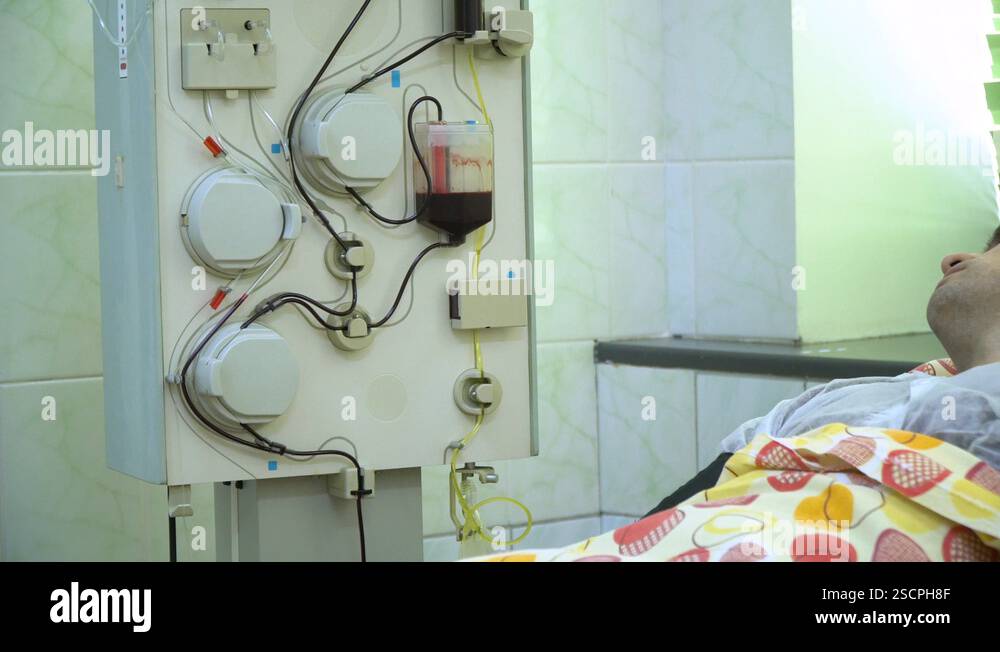 Plasmapheresis. Cleaning the patient's blood through the device. The ...