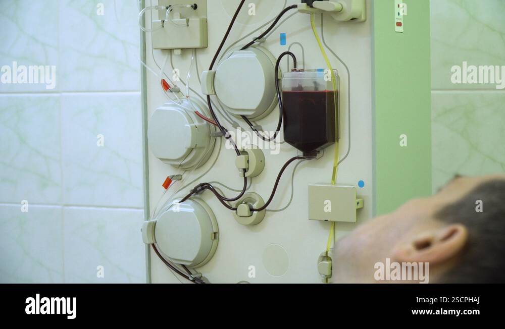 Plasmapheresis. Cleaning the patient's blood through the device. The ...