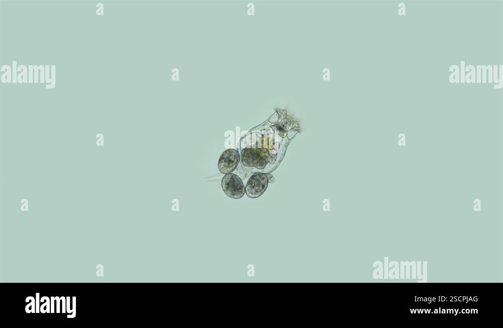Rotifera Brachionus plicatilis under the microscope Stock Video Footage ...