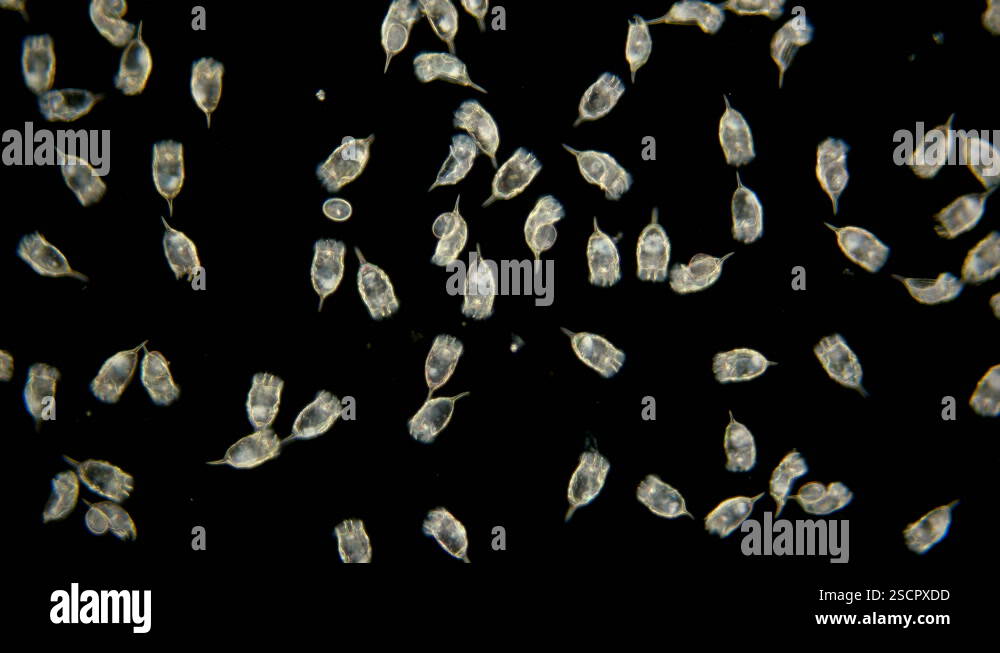 Rotifera Keratella Cochlearis under the microscope Stock Video Footage ...