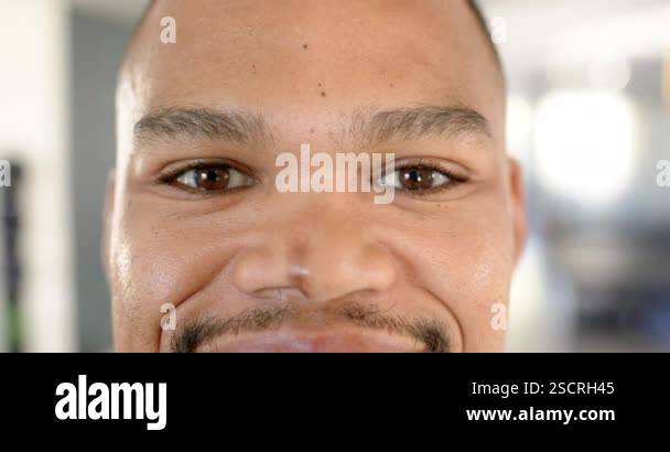 Smiling man with facial scars looking directly at camera, close-up ...