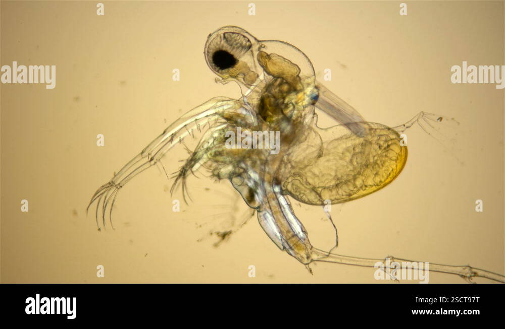 zooplankton under a microscope, prickly water flea Stock Video Footage ...