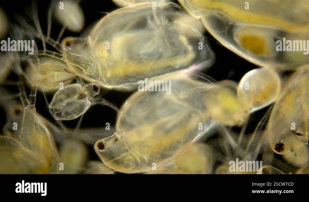 Zooplankton under the microscope. A colony of different plankton ...