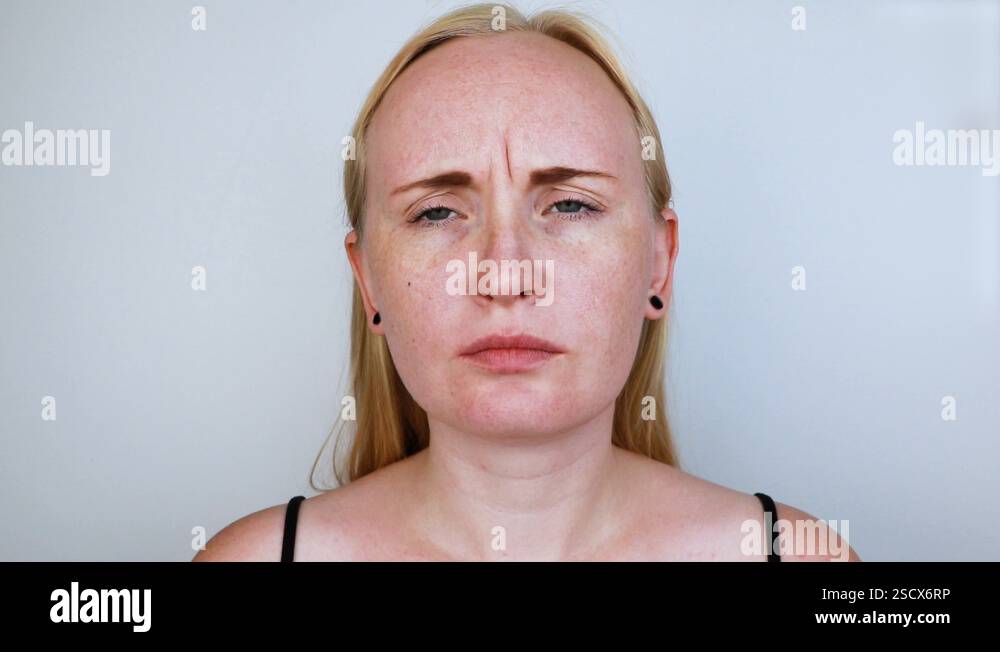 Botox injection in forehead remove Stock Videos & Footage - HD and 4K ...