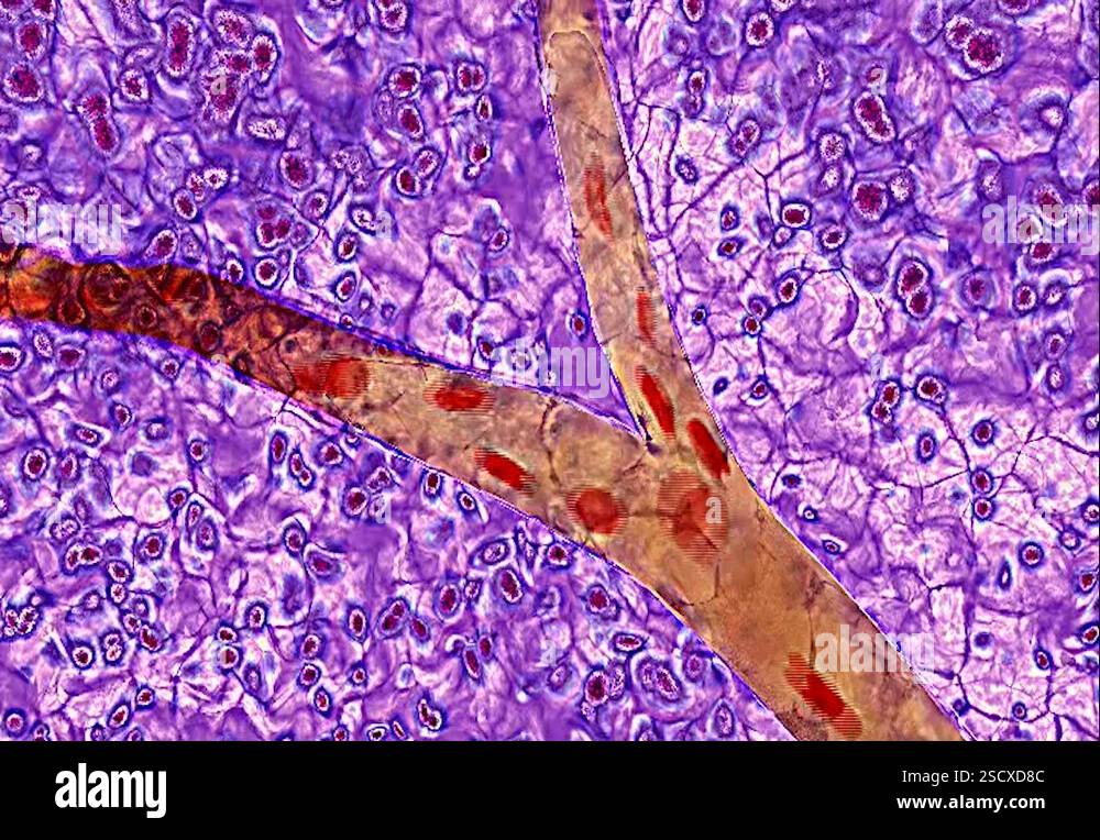 Anemia Blood Flow, Animation Stock Video Footage - Alamy