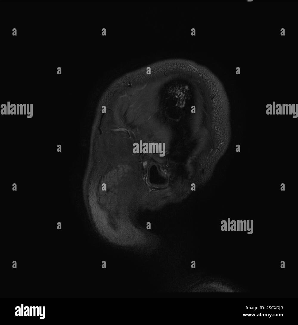 Normal Brain, MRI Stock Video Footage - Alamy