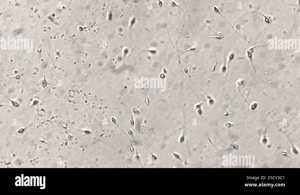 View at human sperm under microscope in lab Stock Video Footage - Alamy