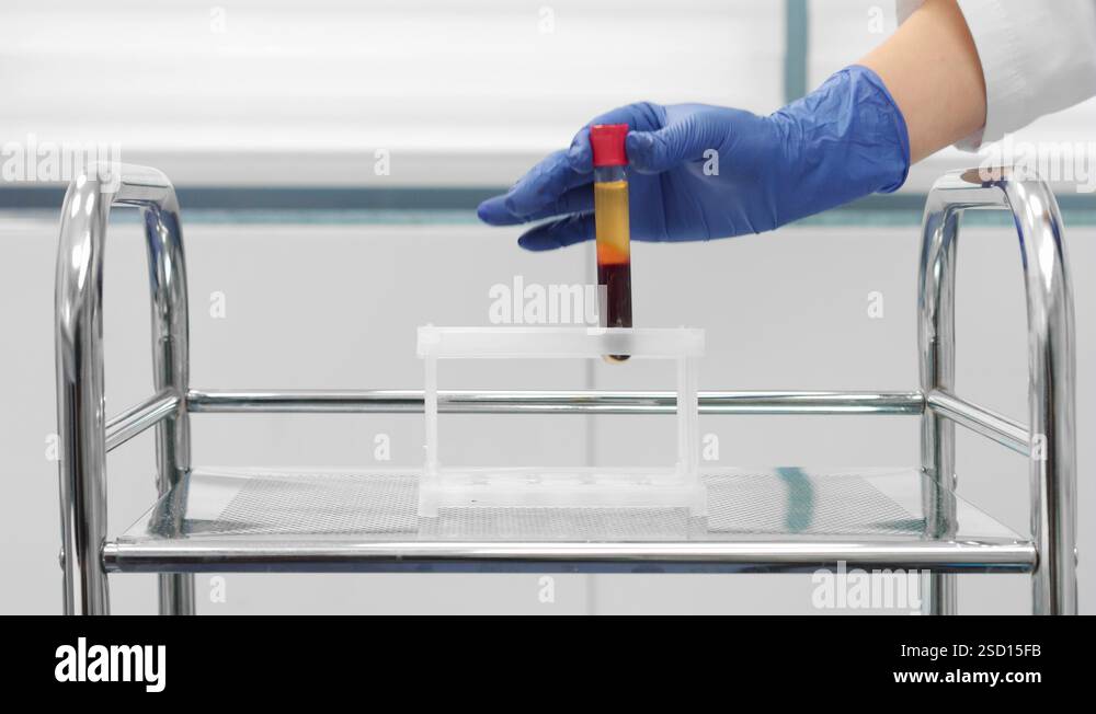 Vacuum blood sample tube with centrifuged blood sample Stock Video ...