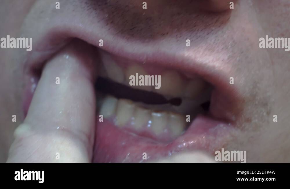 brushing teeth.man applies a special gel with his finger on the gums ...