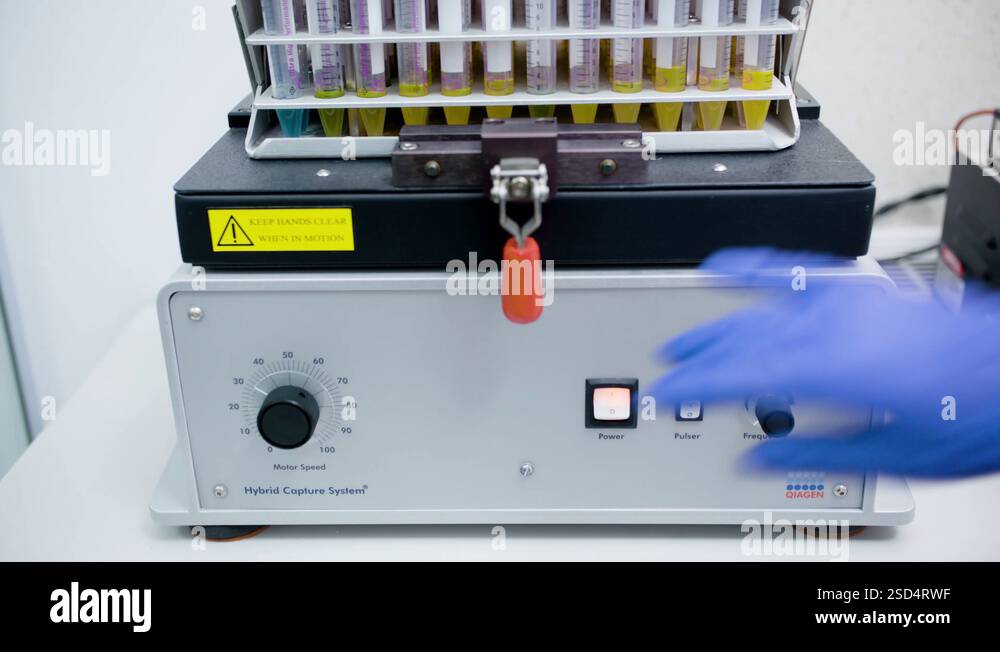 Medical equipment. Lab test tubes vortex mixer. Test results Stock ...