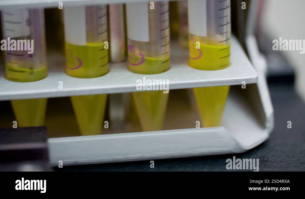 Medical equipment. Lab test tubes vortex mixer. Test results Stock ...