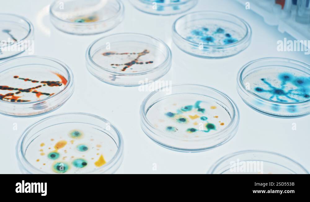 Microbiology Laboratory: Petri Dishes with Various Bacteria Samples ...