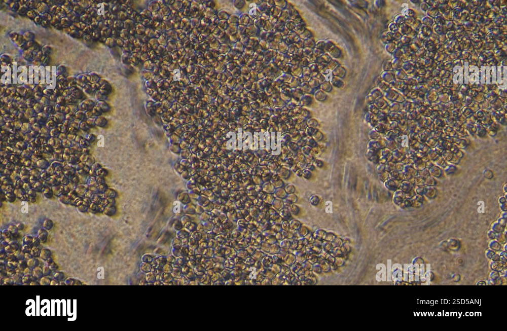 Microscopy of yeast cells (Saccharomyces cerevisiae). Magnification ...